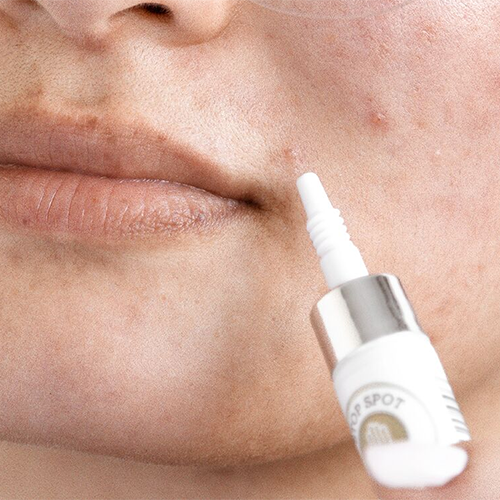 Aspect Gold Stop Spot AU | Adore Beauty