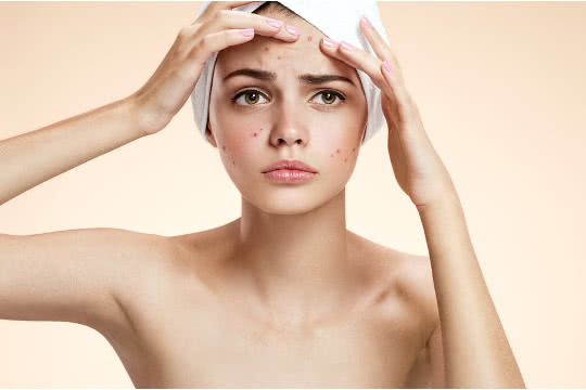 Is It Safe To Squeeze Blackheads