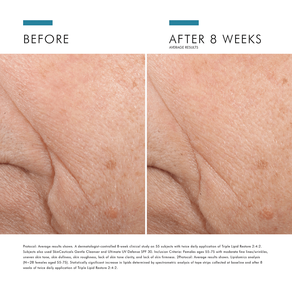 SkinCeuticals Triple Lipid Restore Australia - Adore Beauty