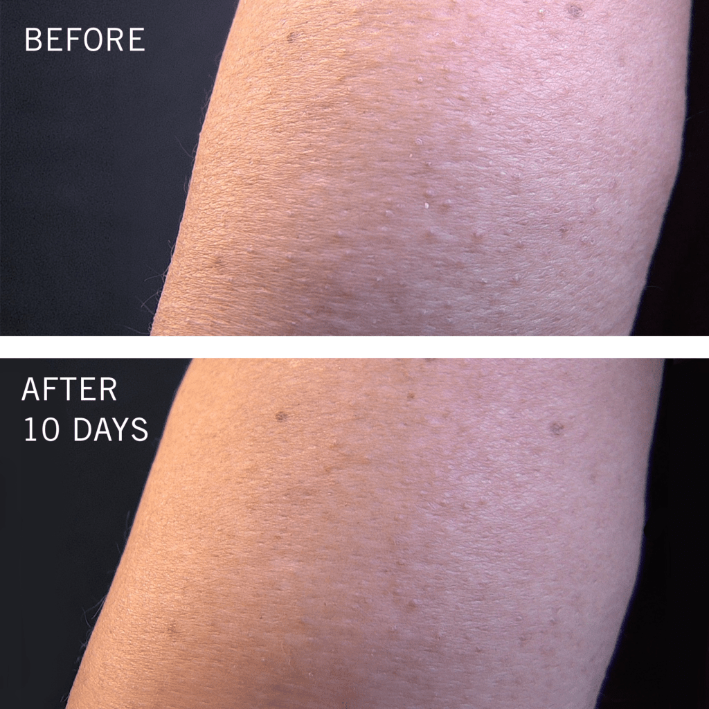 FIRST AID BEAUTY KP Bump Eraser with 10% AHA - Adore Beauty