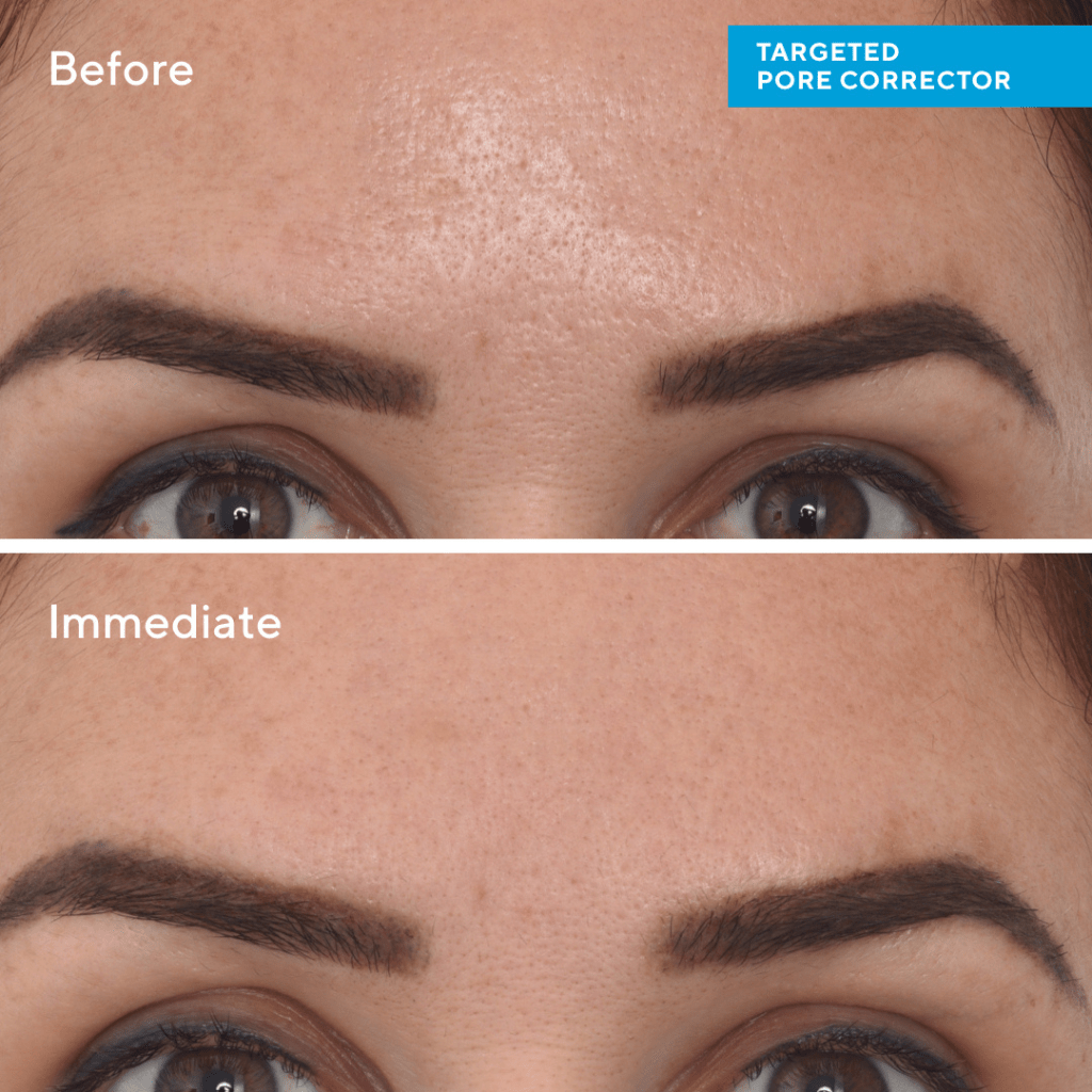 Murad Targeted Pore Corrector - Shop online at Adore Beauty