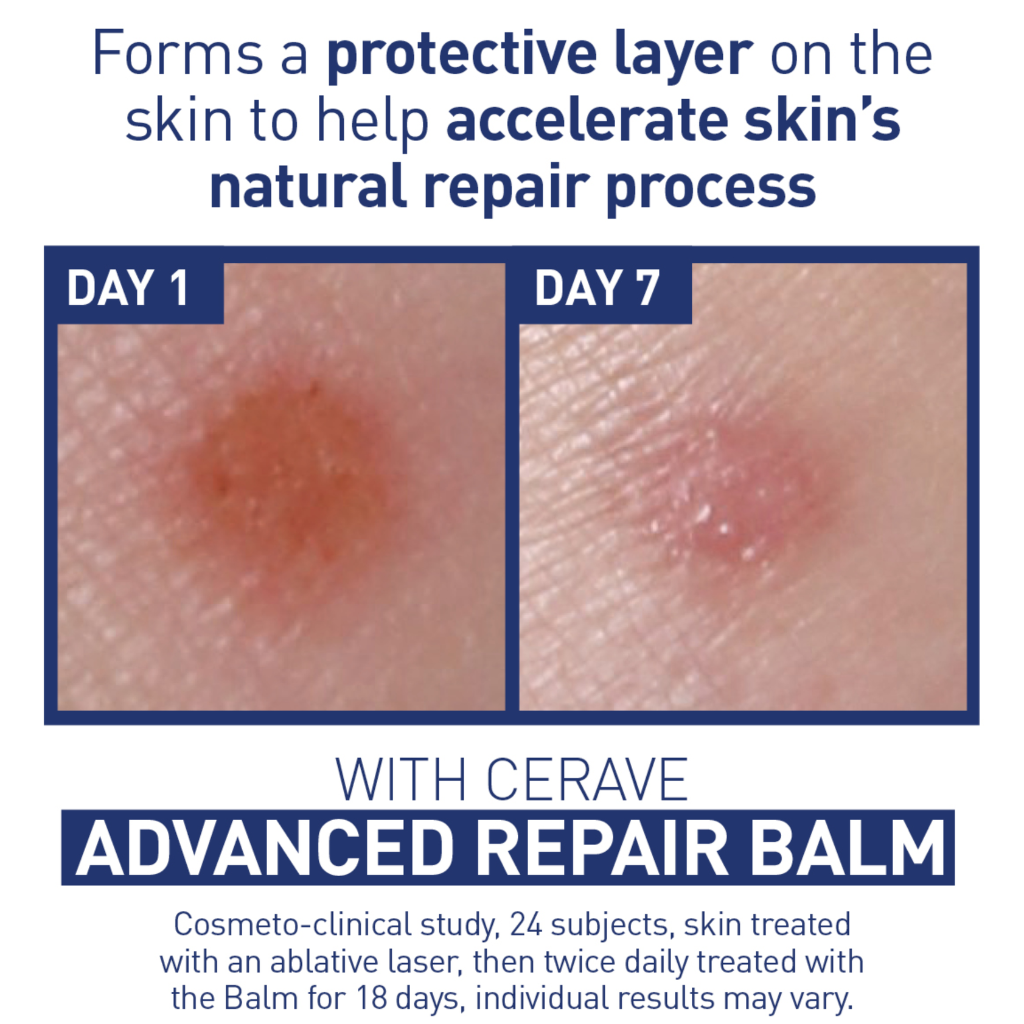 CeraVe Advanced Repair Balm 88ml - Adore Beauty