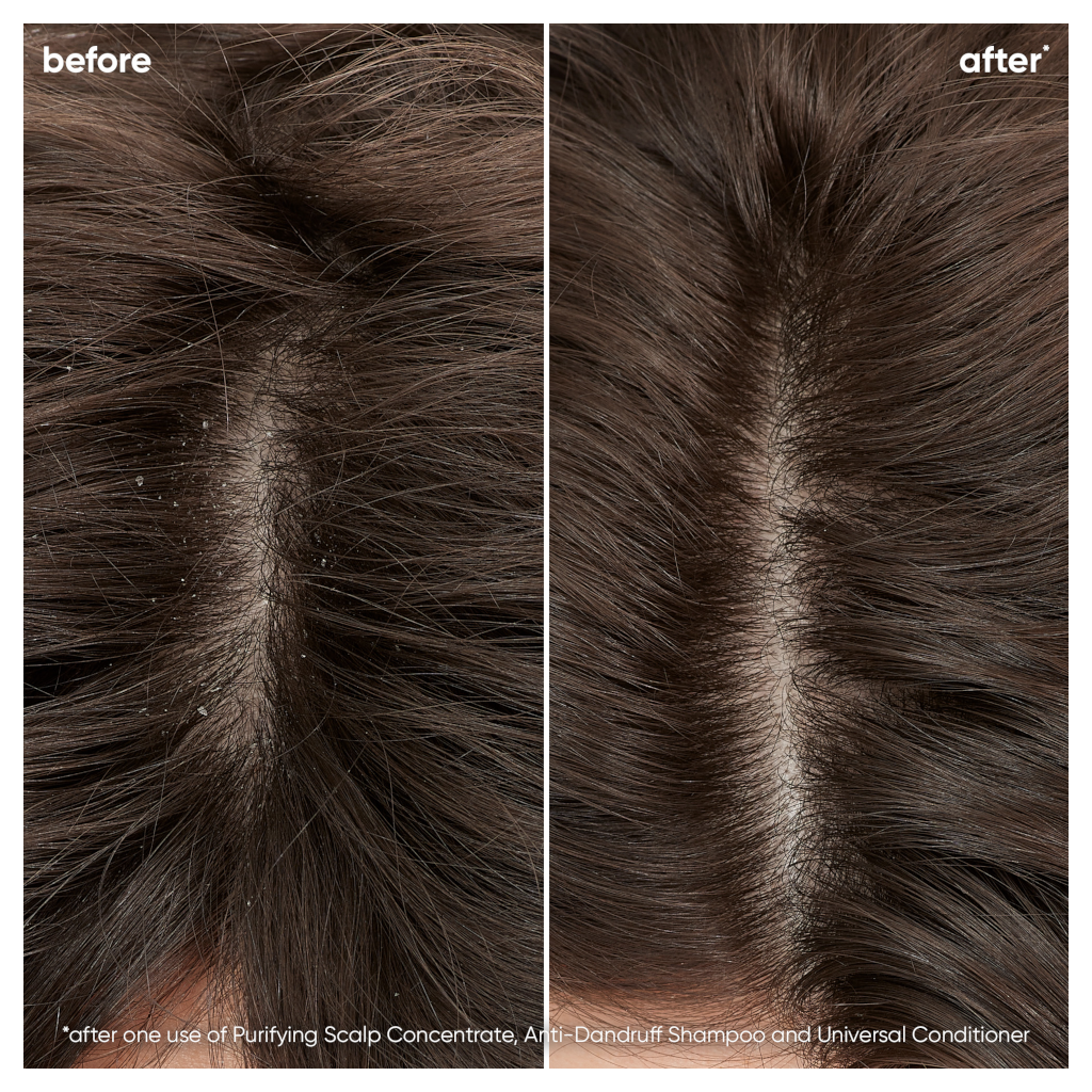 Biolage Scalp Sync Purifying Scalp Concentrate - 200ml