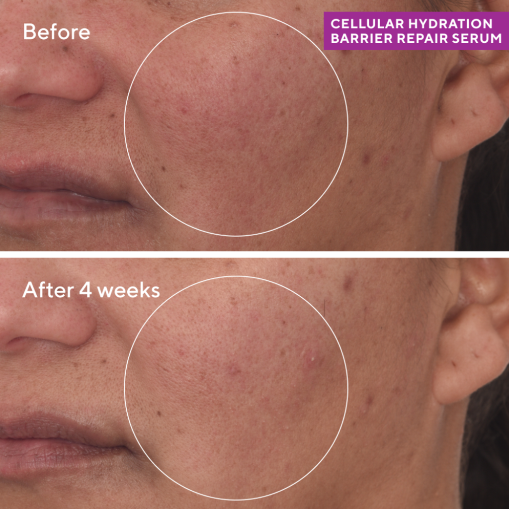 Murad Cellular Hydration Repair Serum 5ml | Shop at Adore Beauty